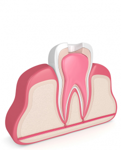 Wurzelkanalbehandlung, Endodontie in Gießen-Wieseck.